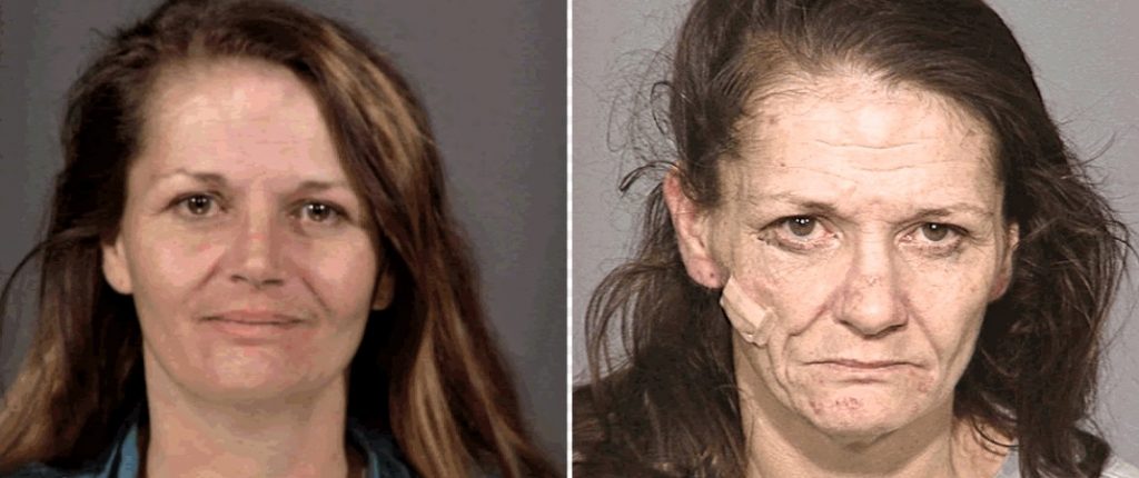 Faces of meth: before and after pictures - Modern Network